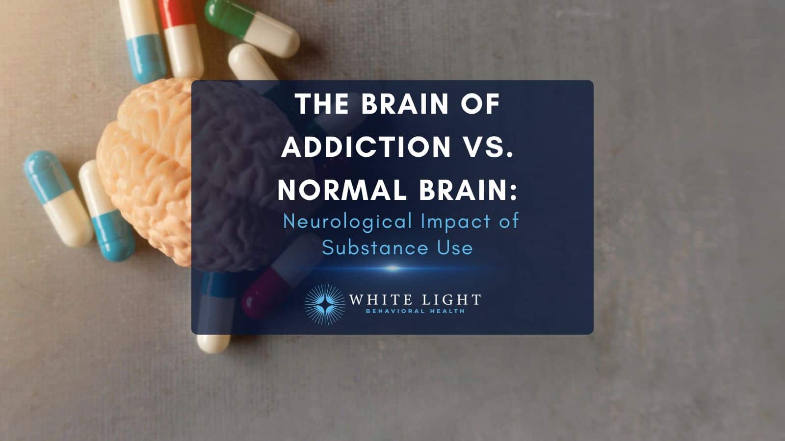 The Brain Of Addiction Vs. Normal Brain: Neurological Impact Of ...